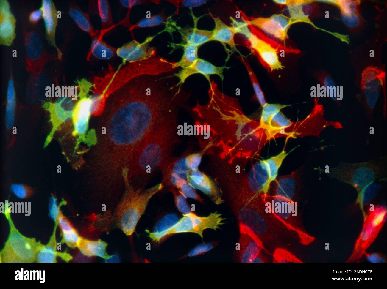 Neuroblastoma cells. Immunofluorescent Light Micrograph of cultured ...