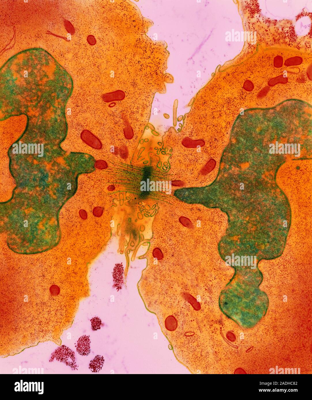 Dividing cancer cell. Coloured transmission electron micrograph (TEM ...