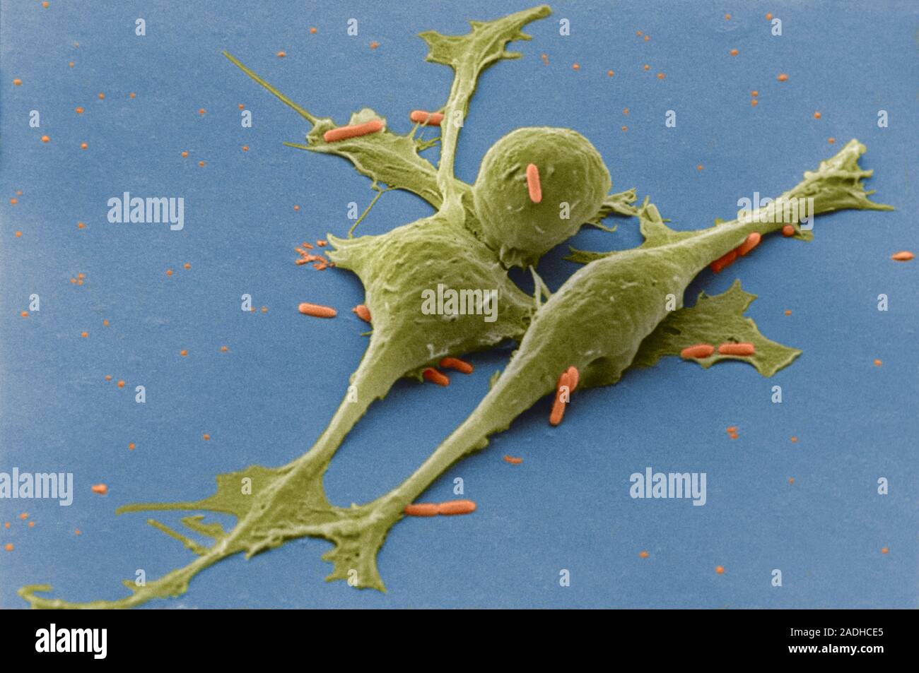Smooth muscle cancer cells. Coloured scanning electron micrograph (SEM ...