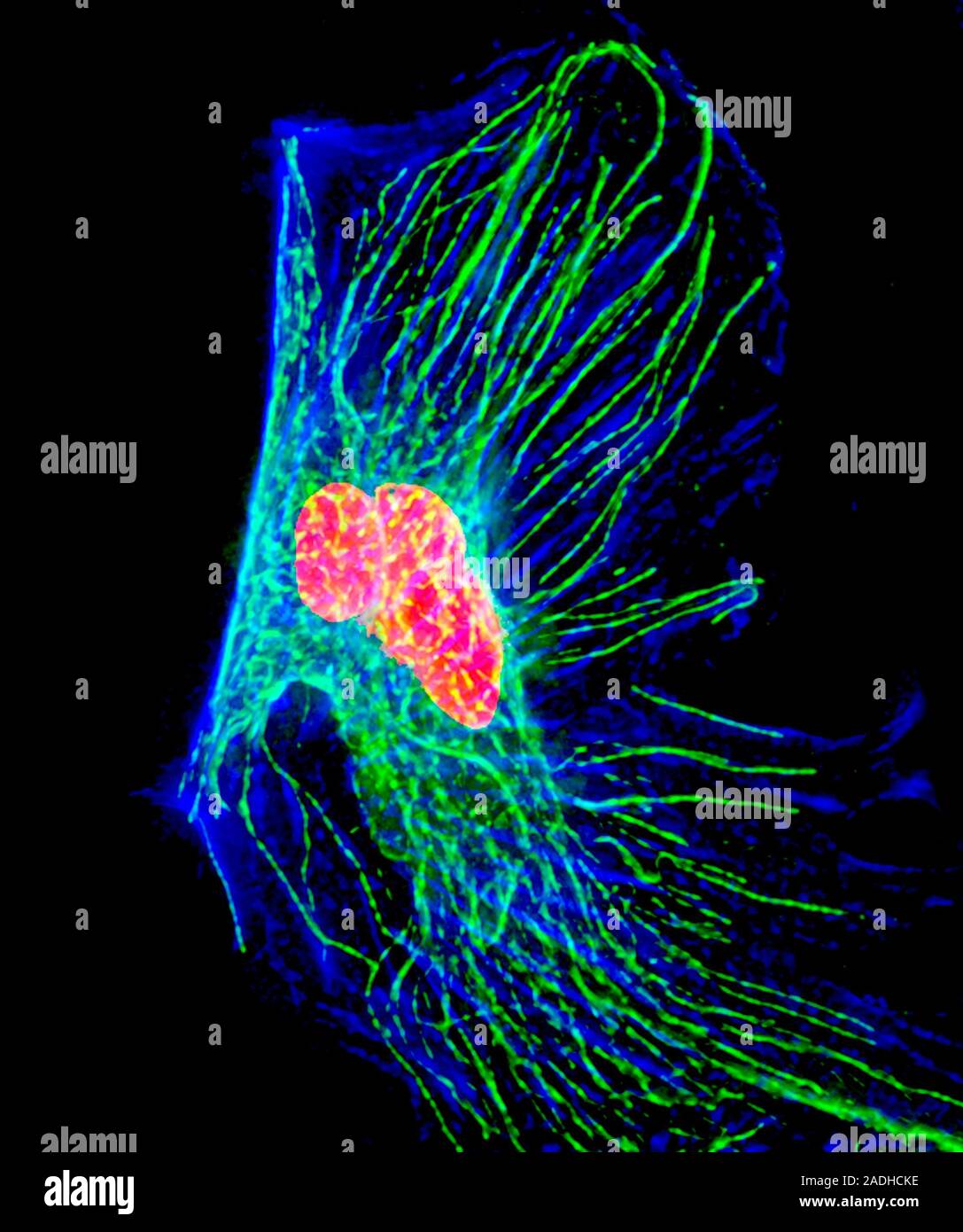 Cancer cell. Immunofluorescent light micrograph of a cancer cell. The ...