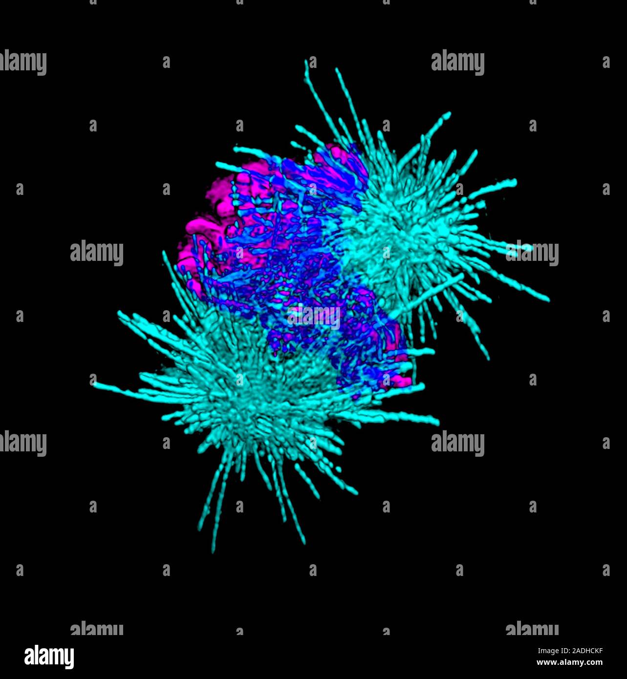 Cancer cell. Immunofluorescent light micrograph of a volume-rendered ...