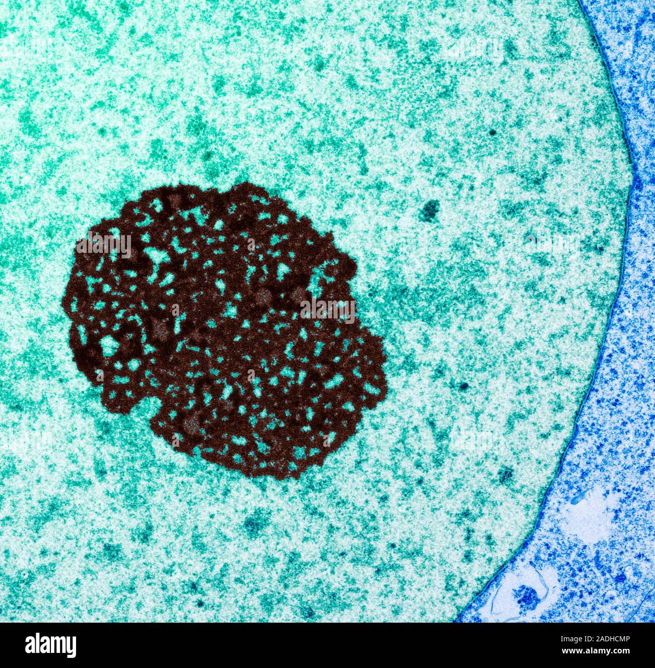 Cancer Cell Nucleolus Coloured Transmission Electron Micrograph Tem