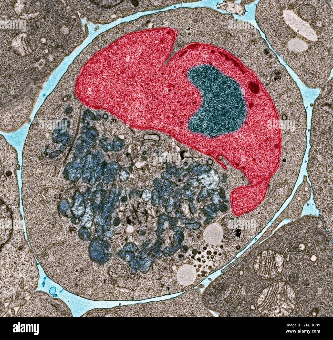 Myeloma cell. Coloured transmission electron micrograph (TEM) of a ...