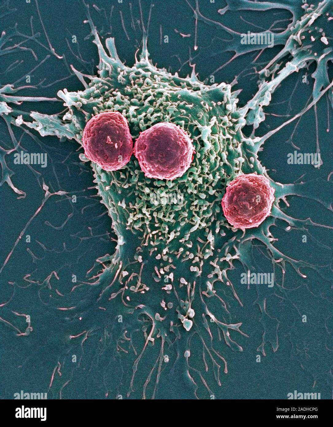 T lymphocytes and cancer cell. Coloured scanning electron micrograph ...