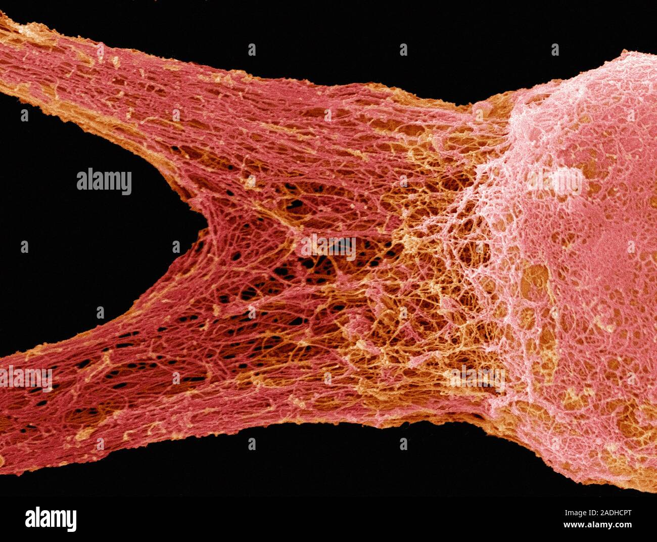 Migrating cancer cell. Coloured scanning electron micrograph (SEM) of a ...