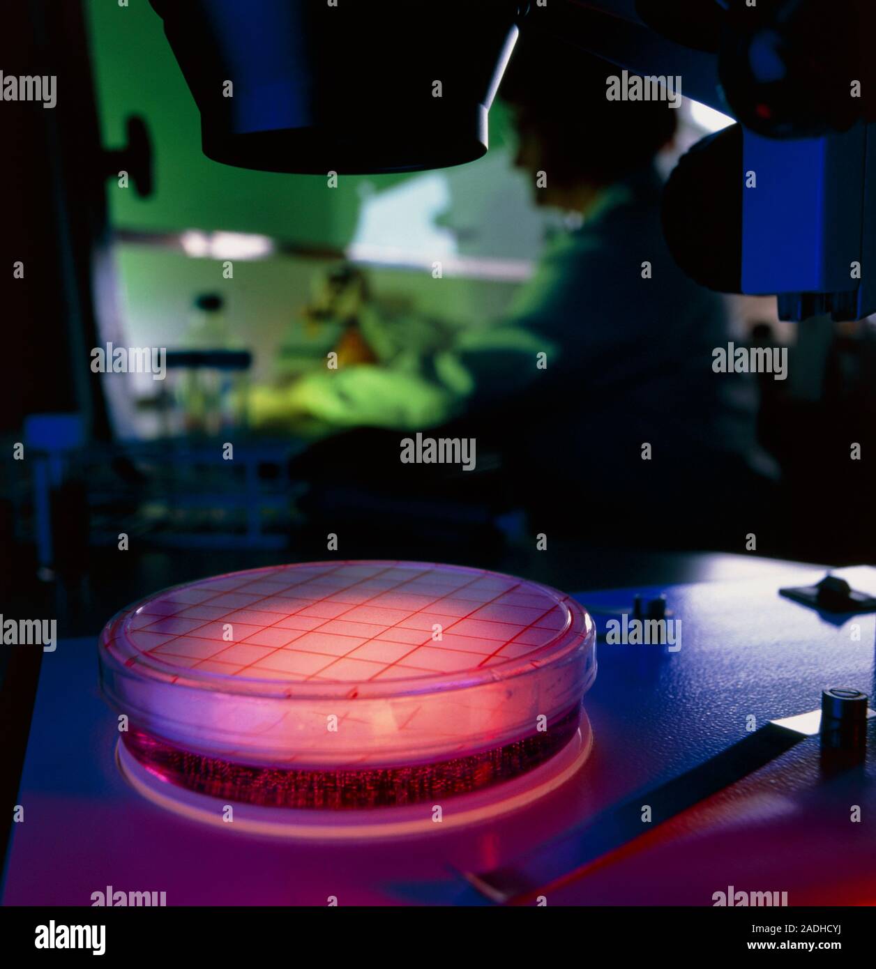 Cancer research. Petri dish containing colonies of cultured human ...