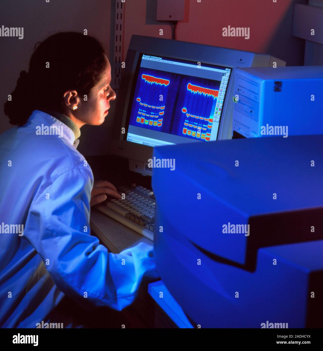 Cancer research. Female researcher examining DNA autoradiographs on a ...