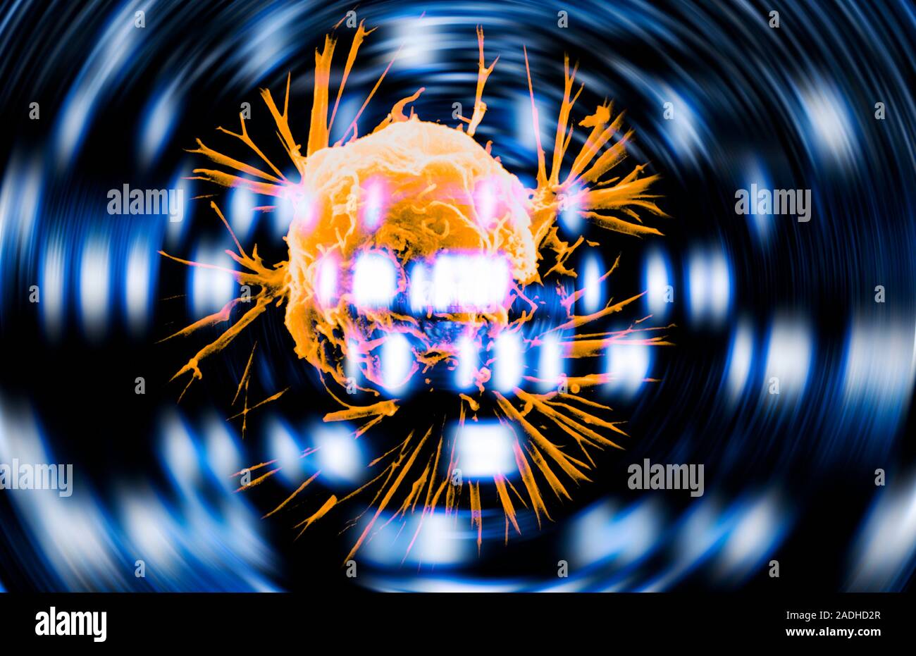 Cancer research. Conceptual computer artwork of a cancer cell (orange ...