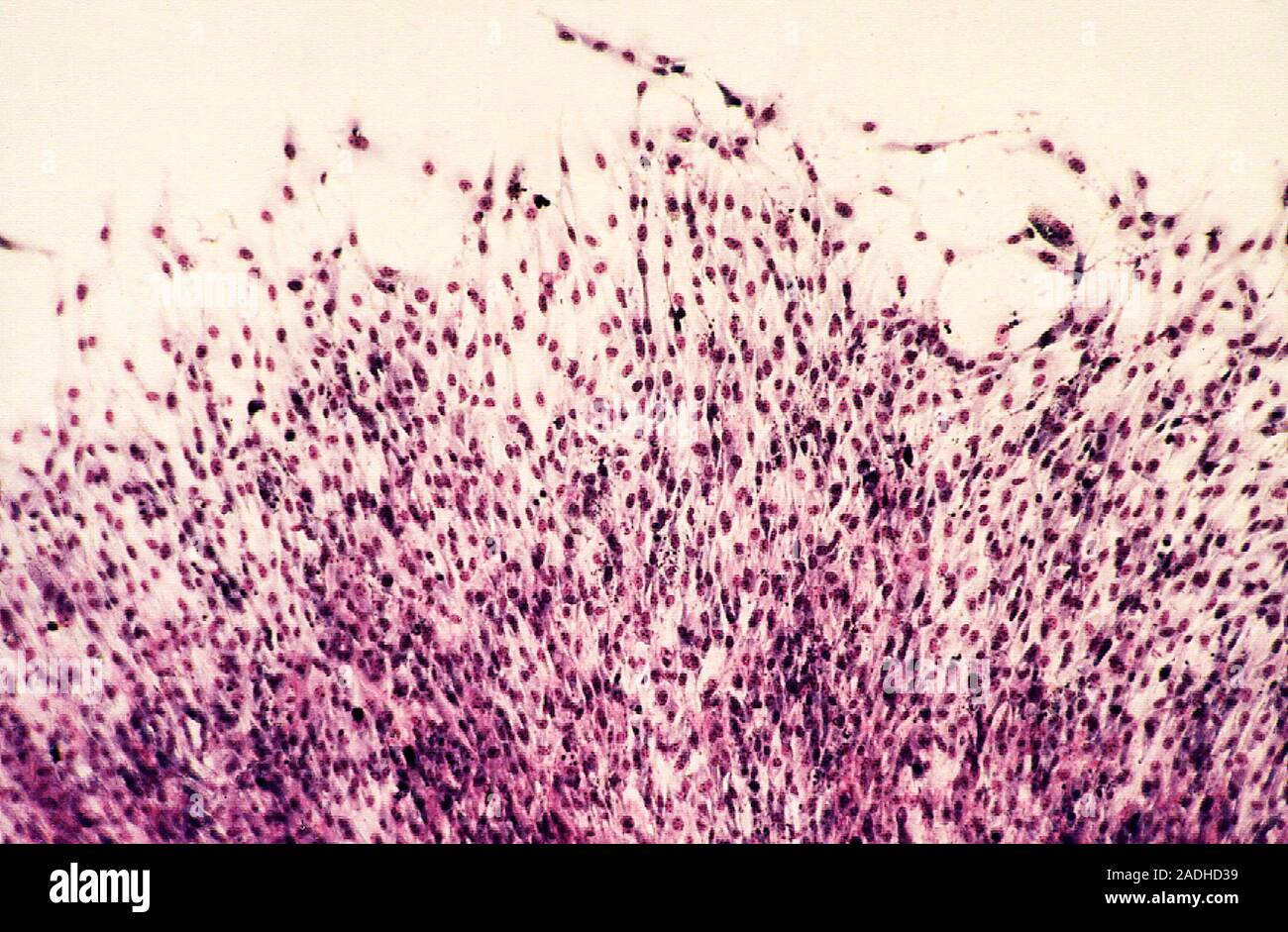 Cancer research. Image 1 of 2. Normal cells. Light micrograph of a ...