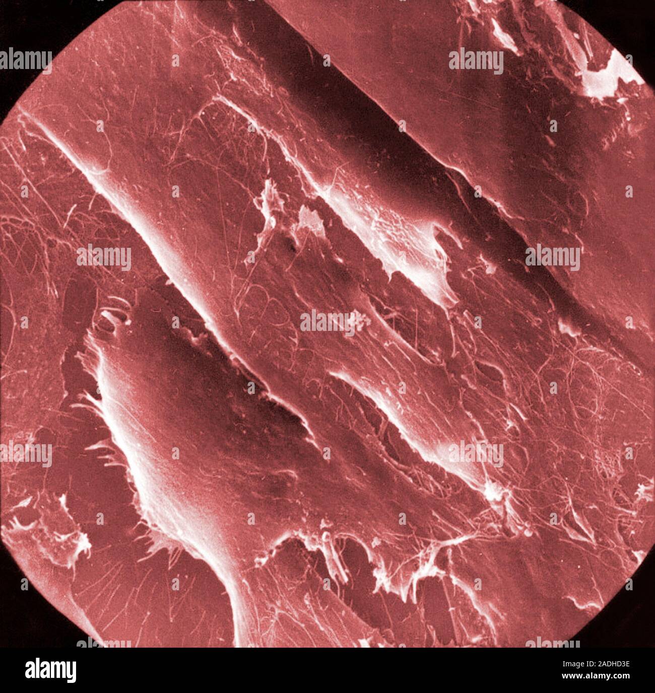 Cancer research. Image 1 of 2. Normal cells. Scanning electron ...