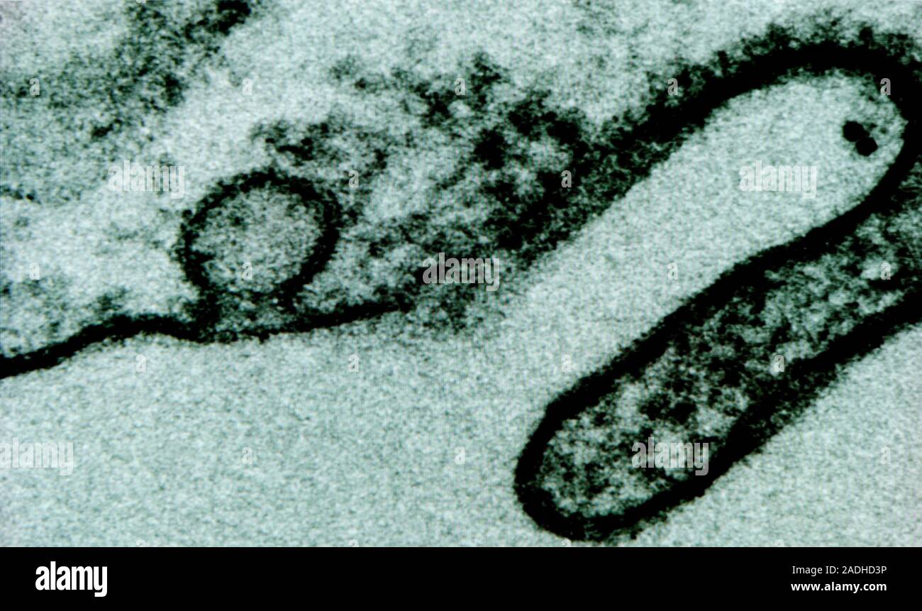 Cancer research. Transmission electron micrograph (TEM) of part of a ...