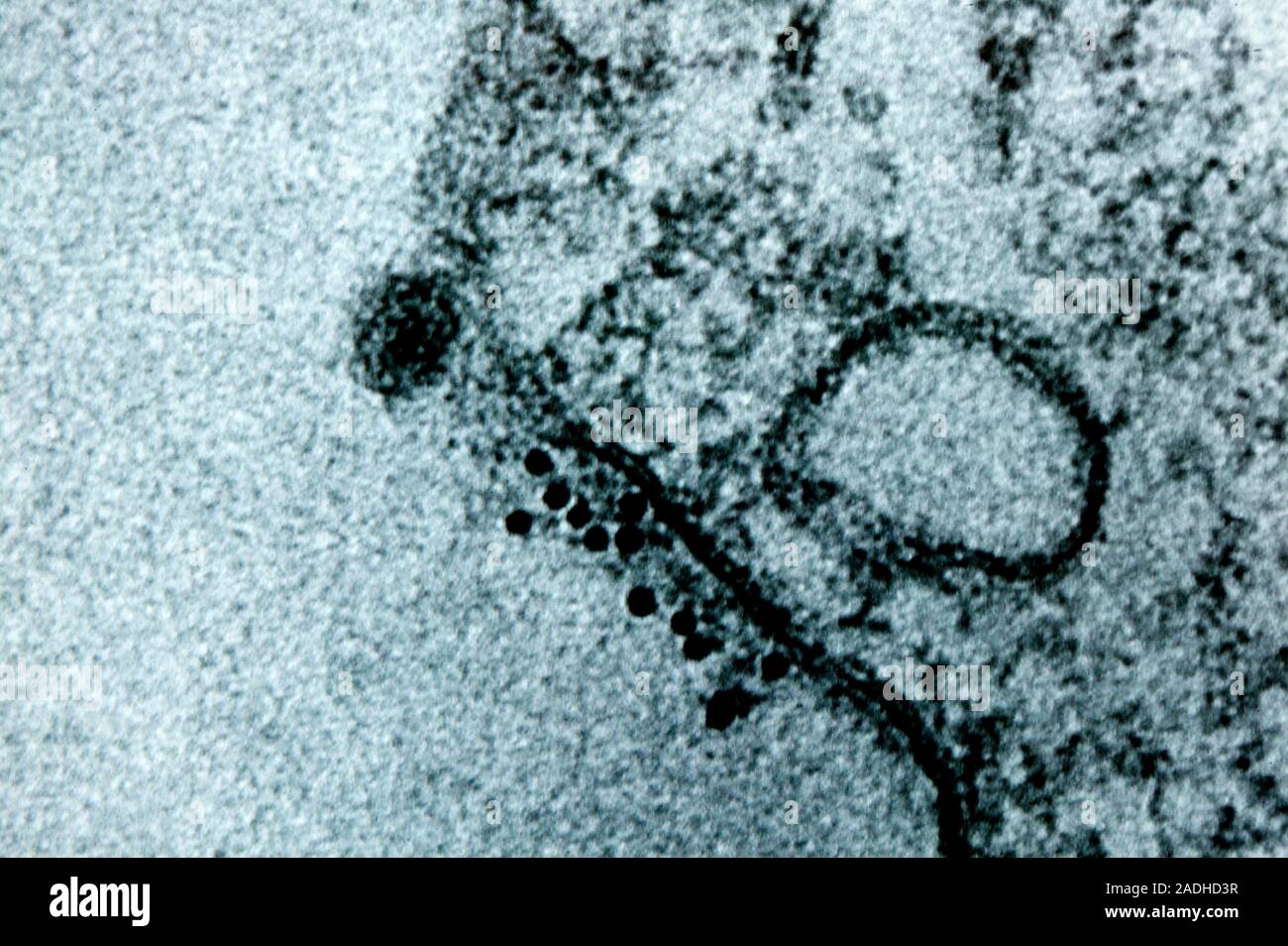 Cancer research. Transmission electron micrograph (TEM) of part of a ...