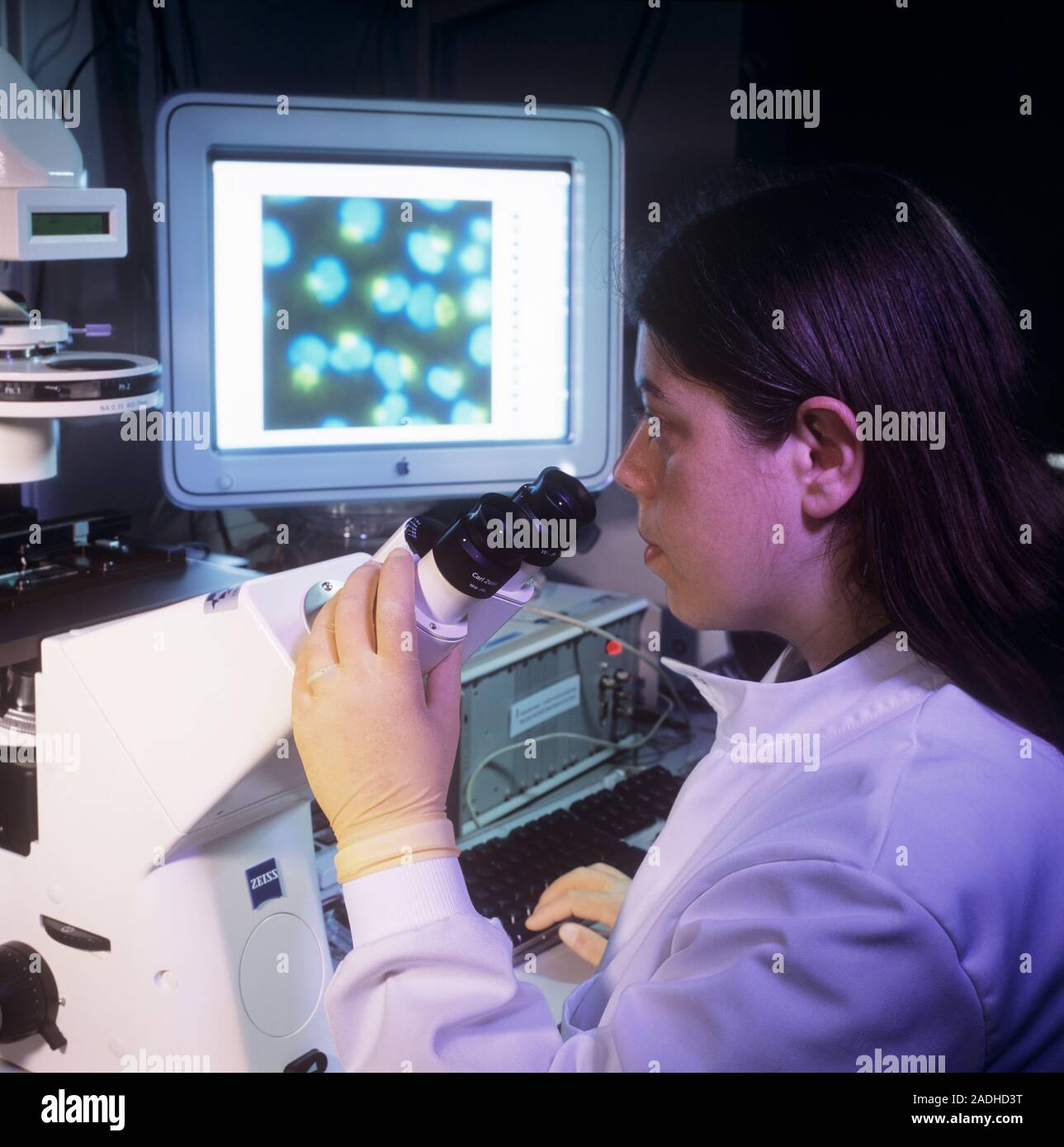 Cancer research. Researcher studying cells under a microscope for ...