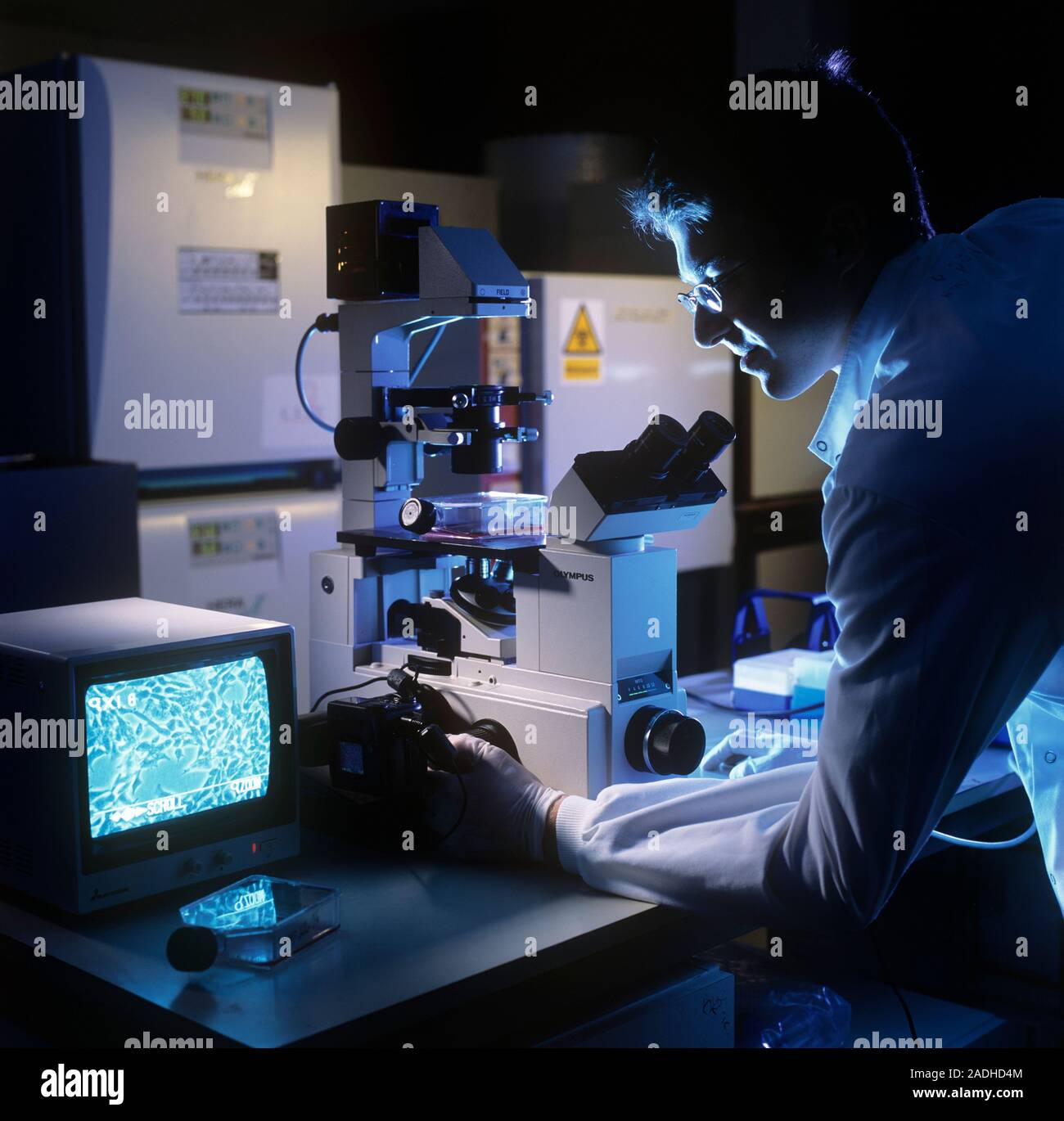 MODEL RELEASED. Cancer research. Researcher studying cancer cells under ...