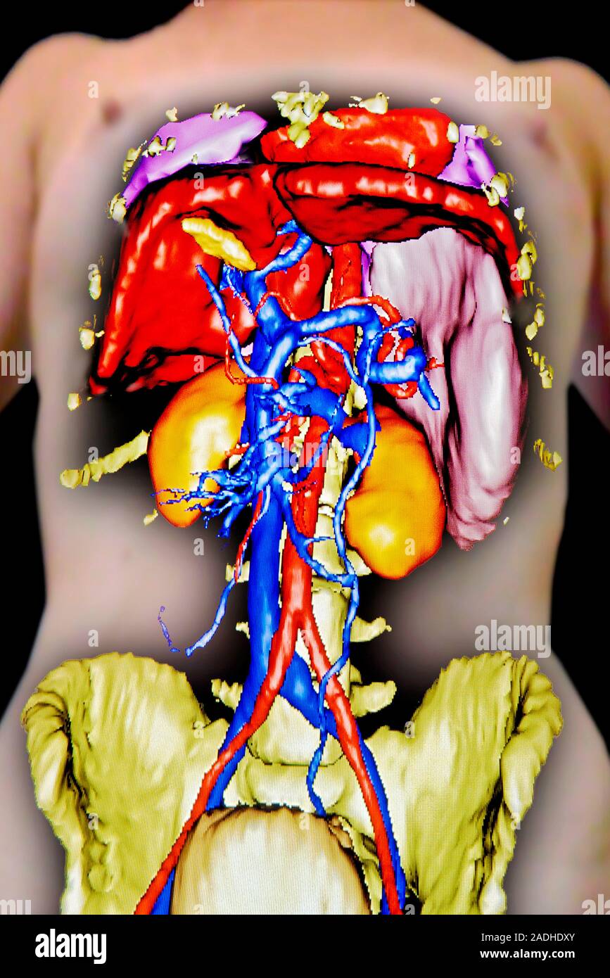 Magnetic resonance imaging (MRI) scanning to detect cancers. This ...