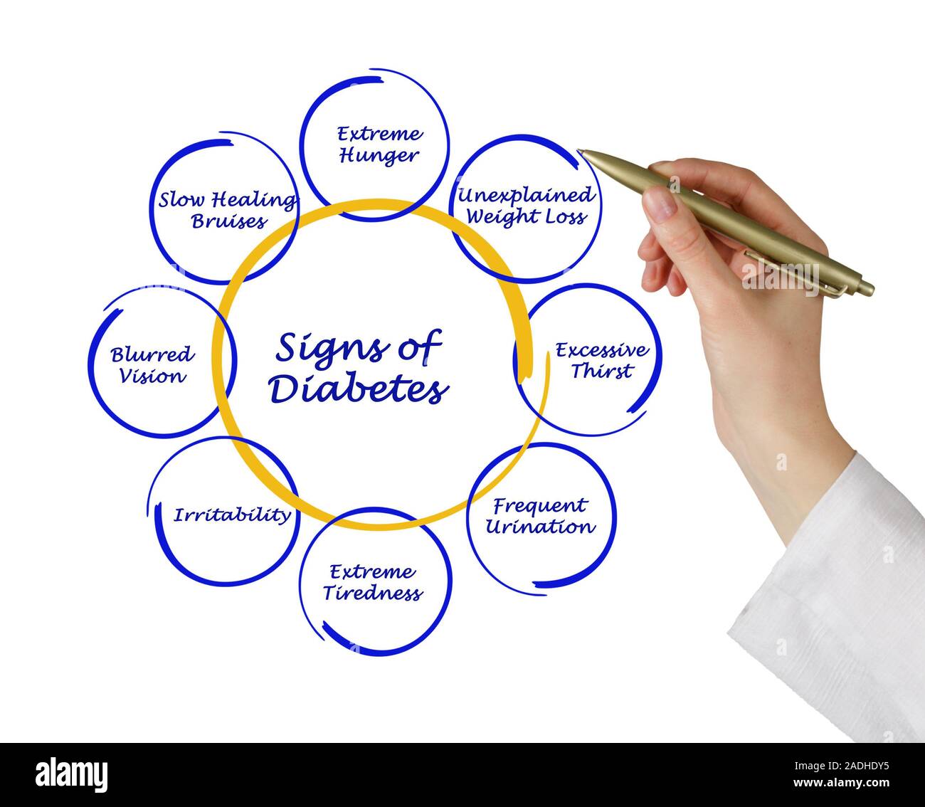 Sign of diabetes Stock Photo - Alamy