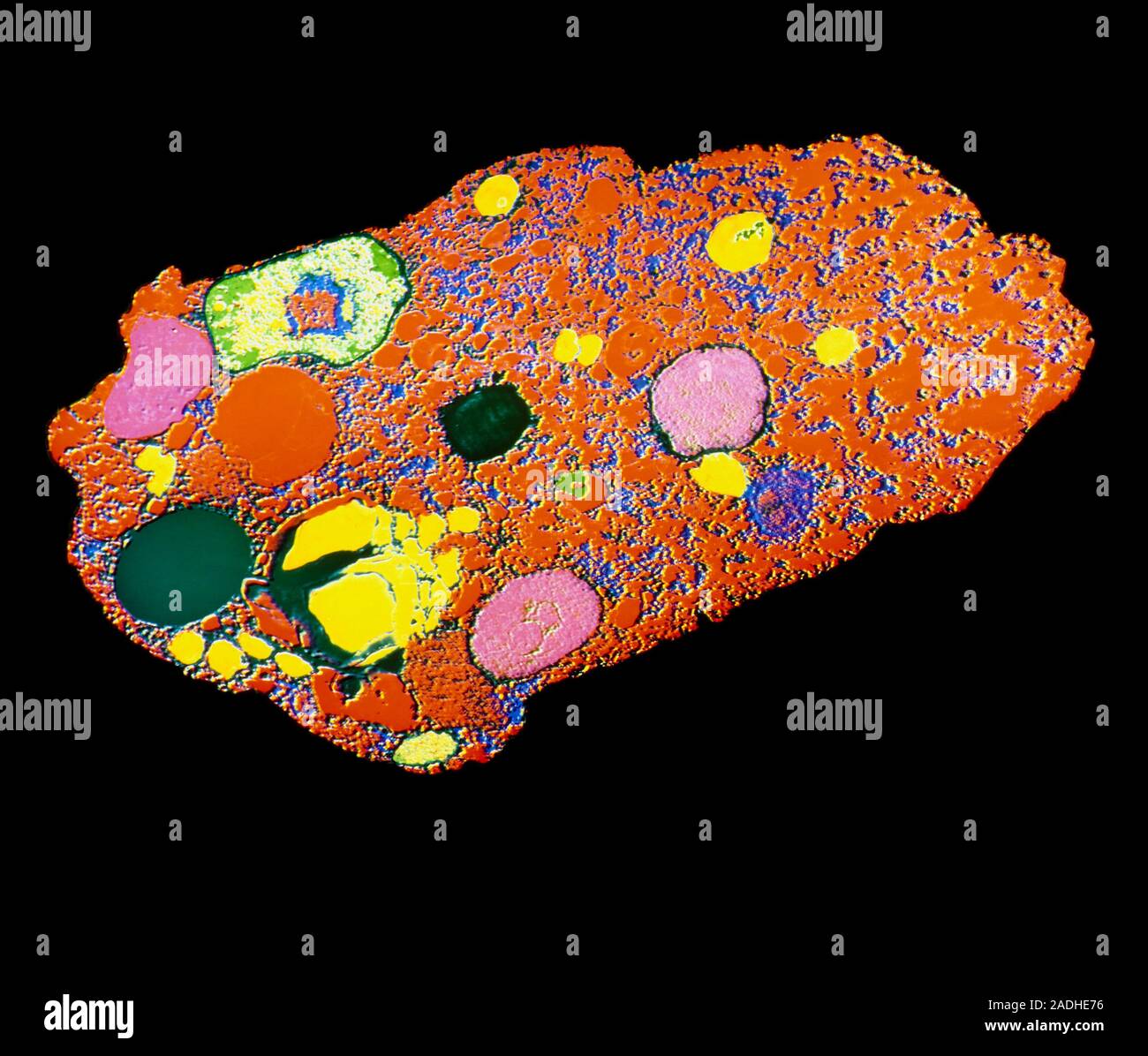 False-colour transmission electron micrograph of Entamoeba histolytica ...