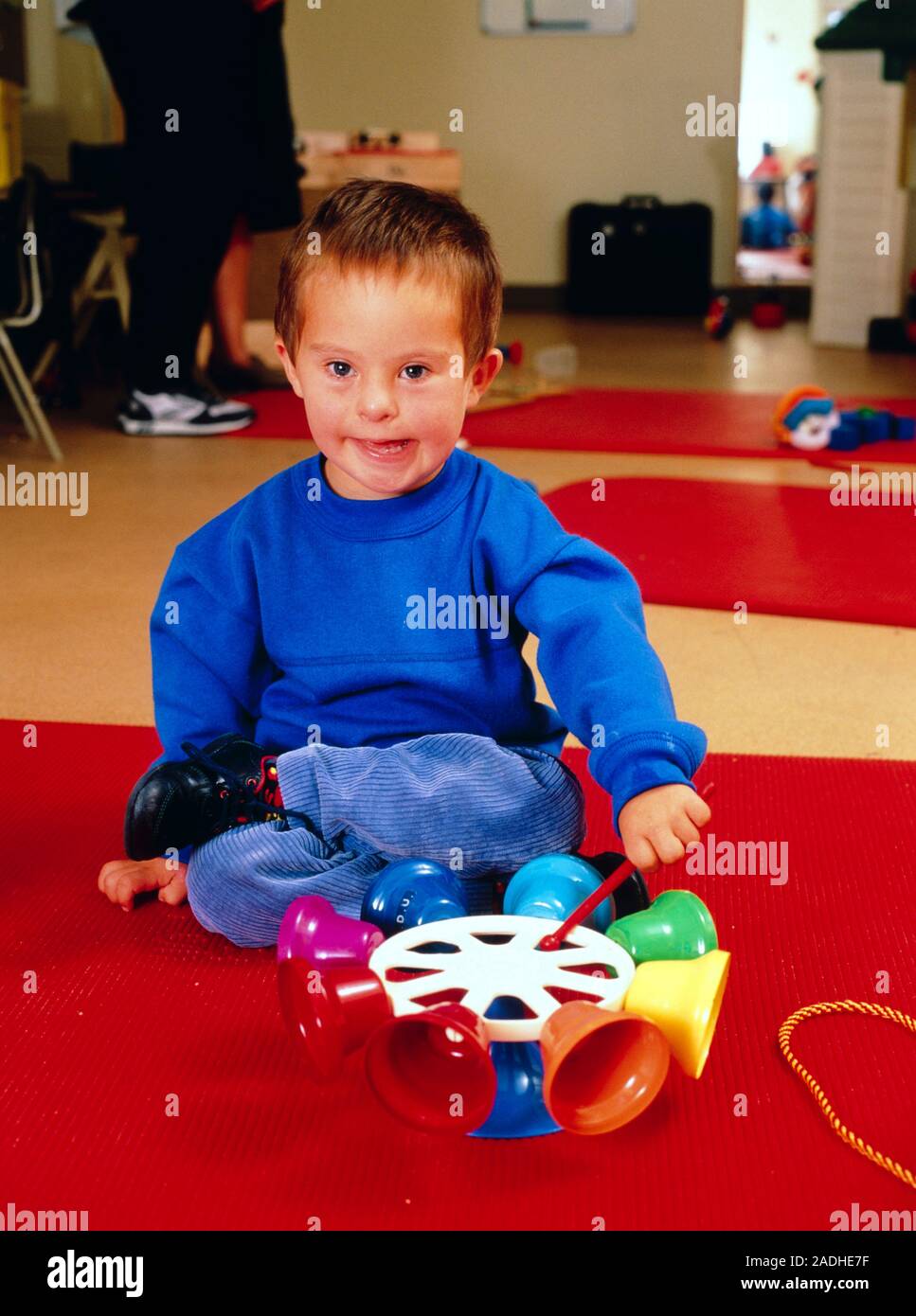 Model released: A young boy with Down's syndrome. Down's syndrome (also ...