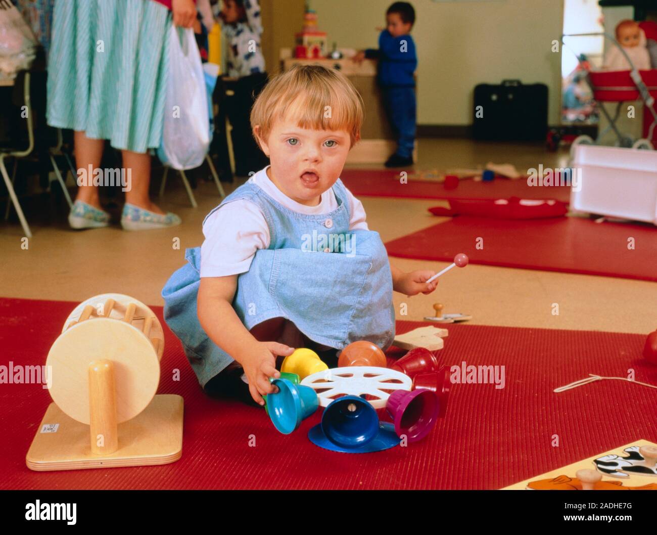 Model released: A young girl with Down's syndrome. Down's syndrome ...