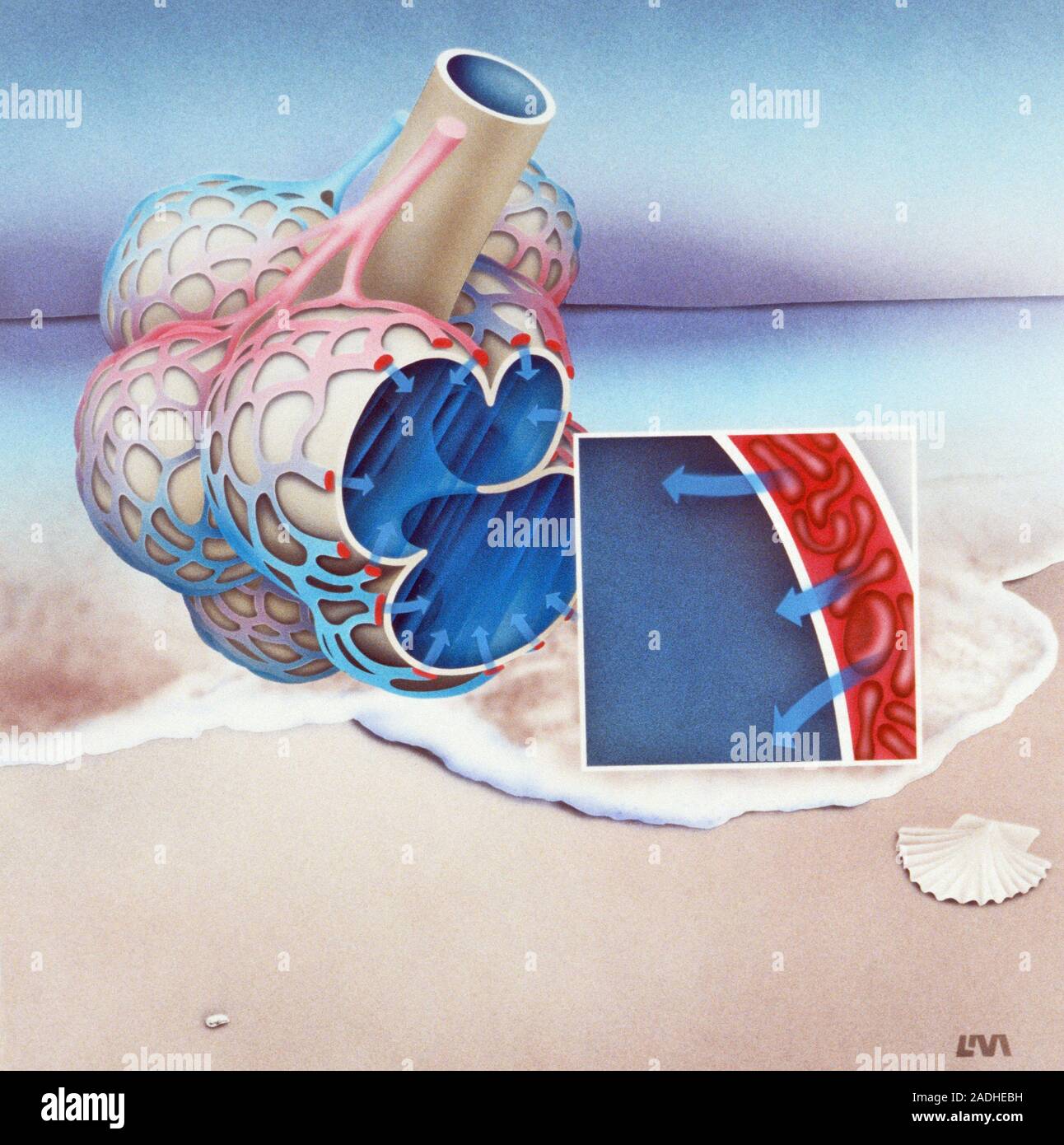 Saltwater drowning. Illustration of the effect of drowning in sea water ...