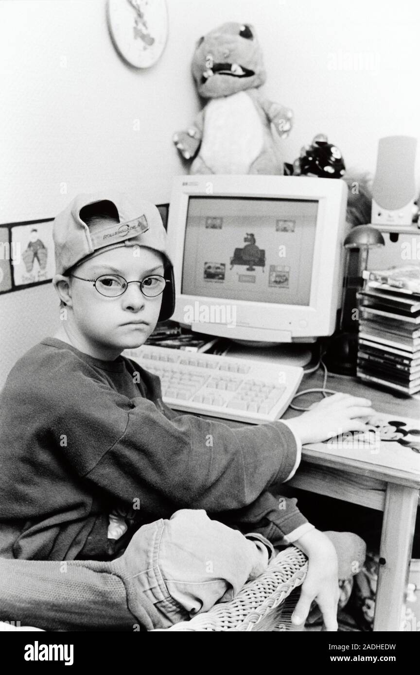 Boy with Down syndrome at his computer. Down's syndrome is a ...
