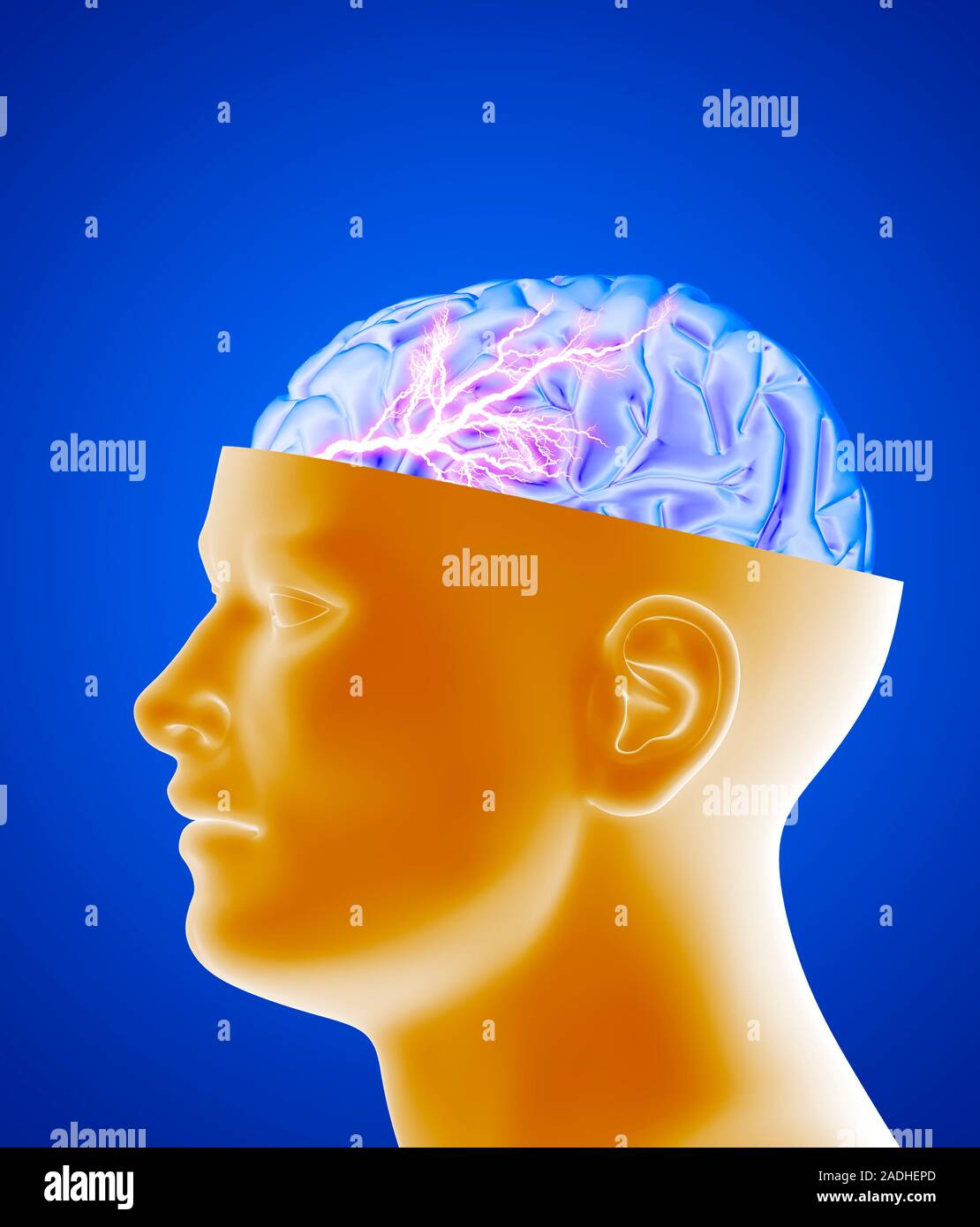 Epilepsy. Conceptual computer artwork of a brain in a cutaway human ...