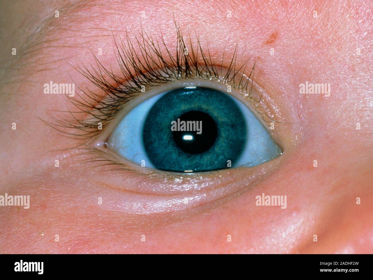 Blue sclera. Close-up of the eye of a 6-month-old baby girl, showing ...