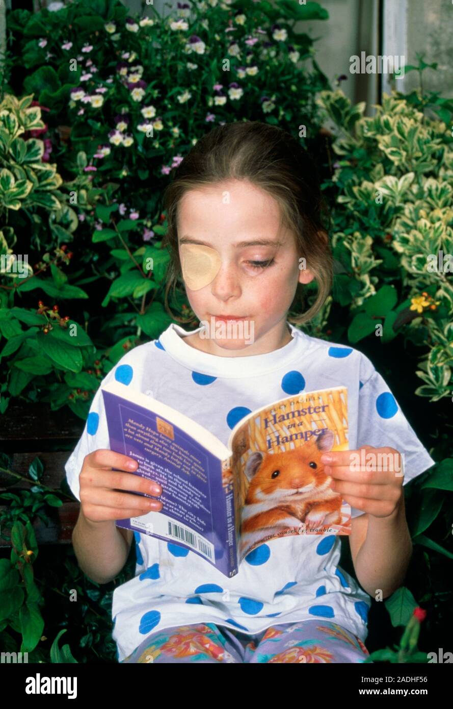 Lazy eye. Girl, aged 8, wears an eye patch over her right eye to treat ...