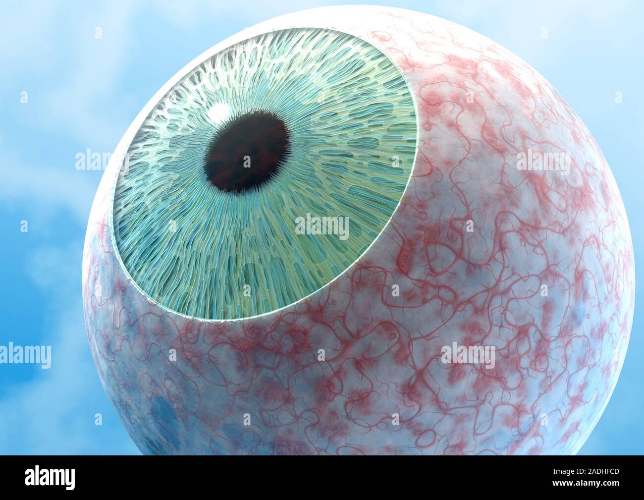 Conjunctivitis, conceptual artwork. Bloodshot eye (red blood vessels ...