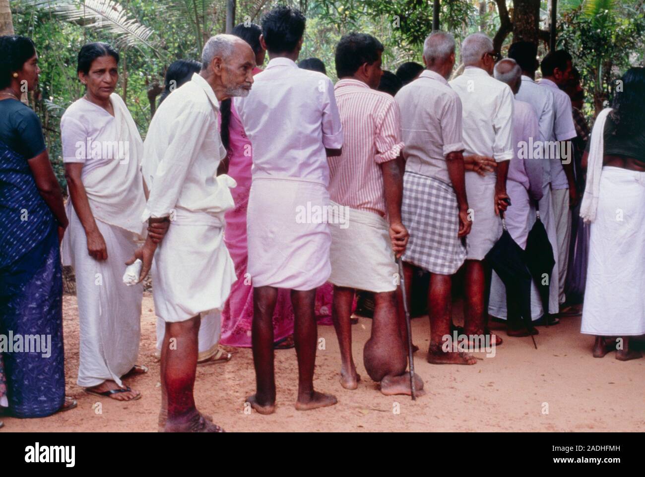 Filariasis patients. Filariasis patients queue at a village clinic in ...