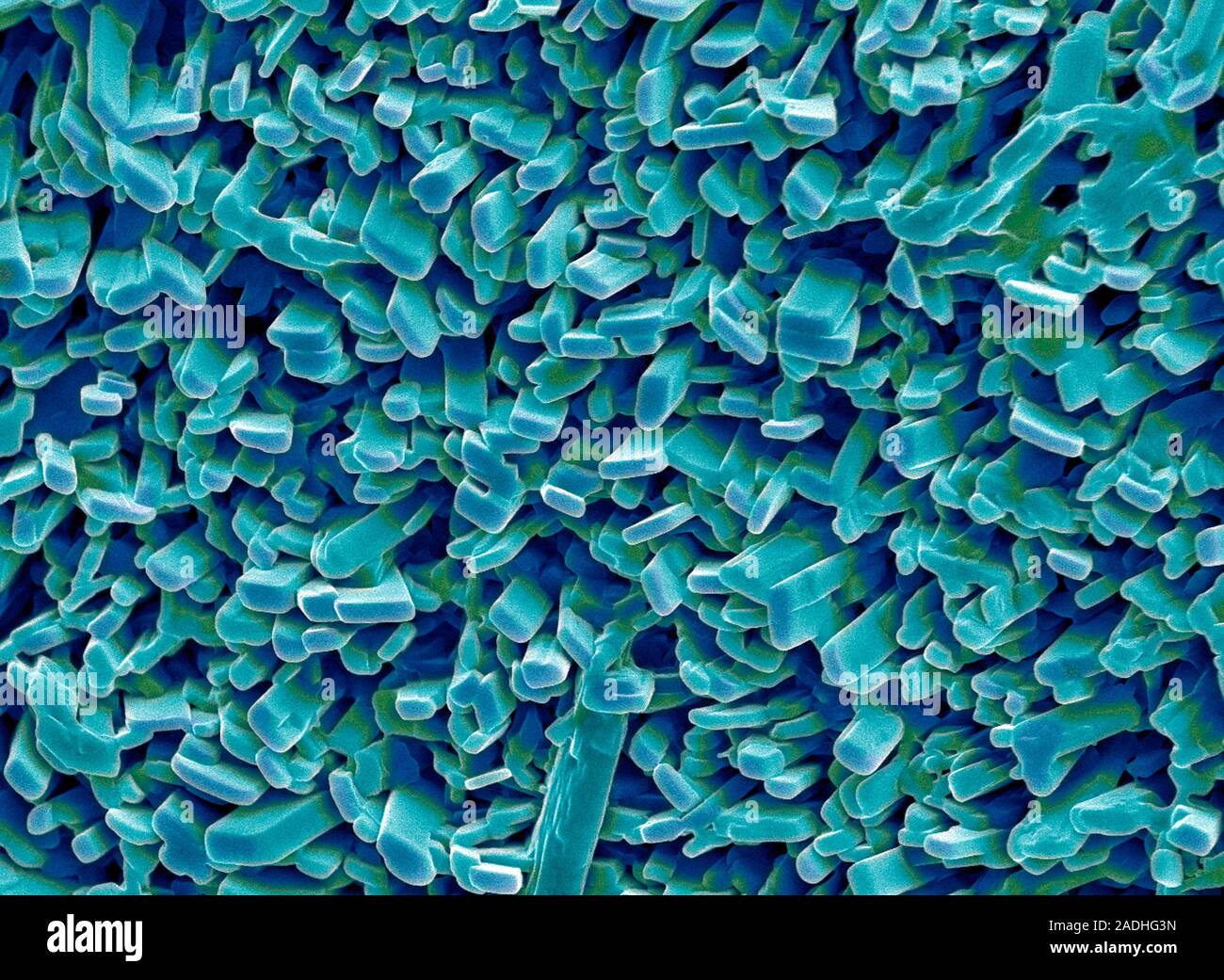 Fractured gallstone. Coloured scanning electron micrograph (SEM) of a ...