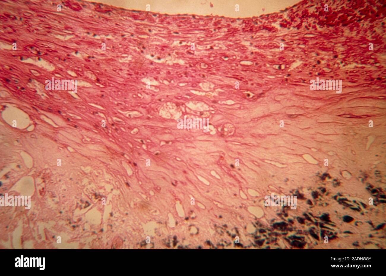 Light micrograph of a section through a human medium- sized artery ...