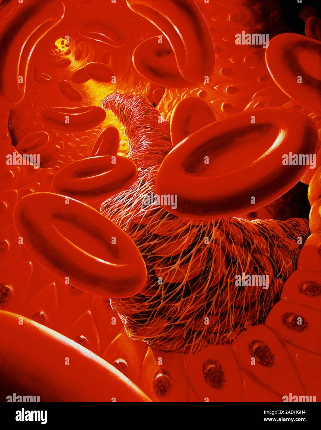 Illustration of the interior of a human blood vessel, showing a snake ...