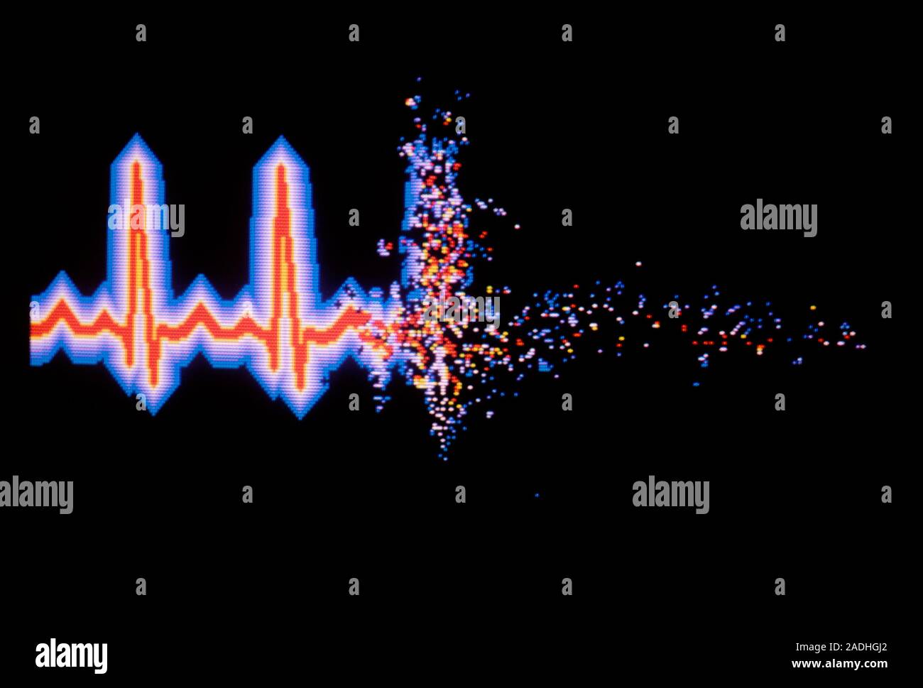 Heart failure: abstract computer graphics image based on a fading ...
