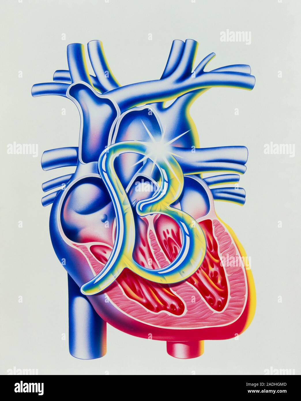 Heart Disease And Beta Blocker Drugs Artwork Of A Heart And A Symbol Representing The Use Of