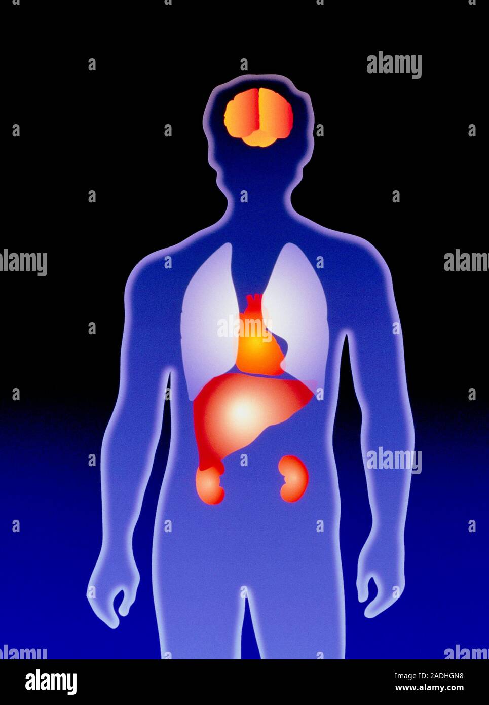 Organs affected by heart failure. Computer artwork depicting a standing ...