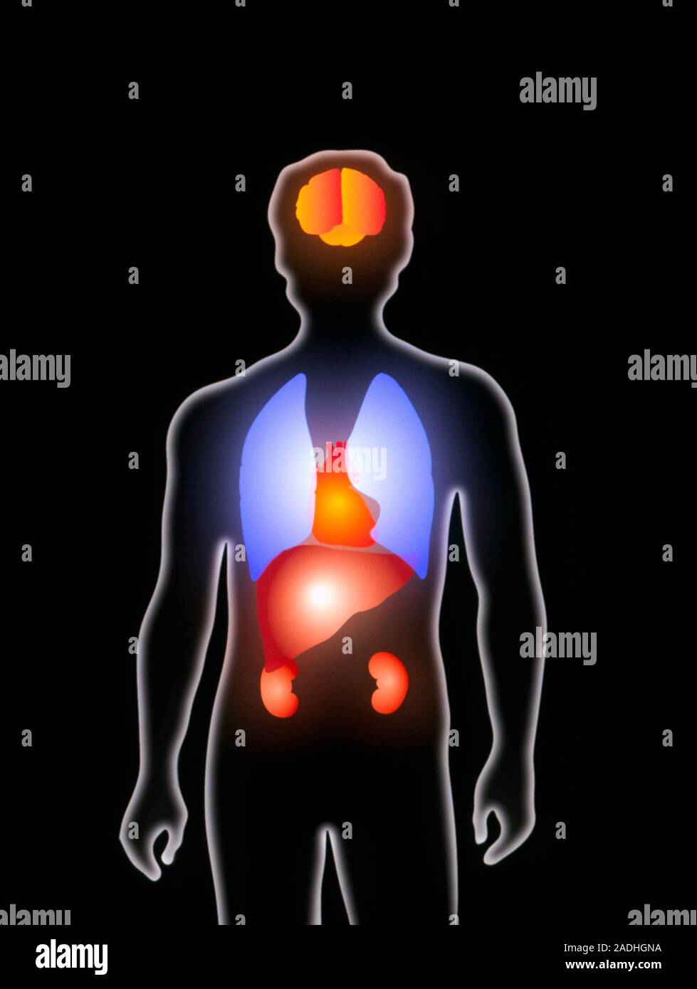 Organs affected by heart failure. Computer artwork depicting a standing ...