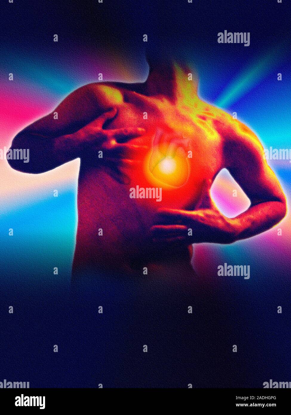 Angina or heart attack. Computer artwork of a man clutching his chest ...