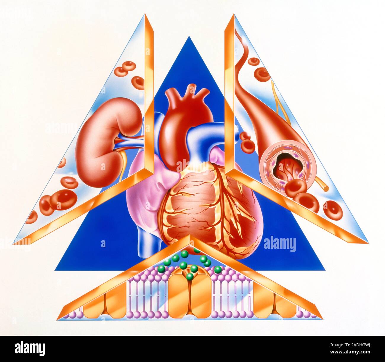 High blood pressure. Artwork of some of the effects of high blood ...
