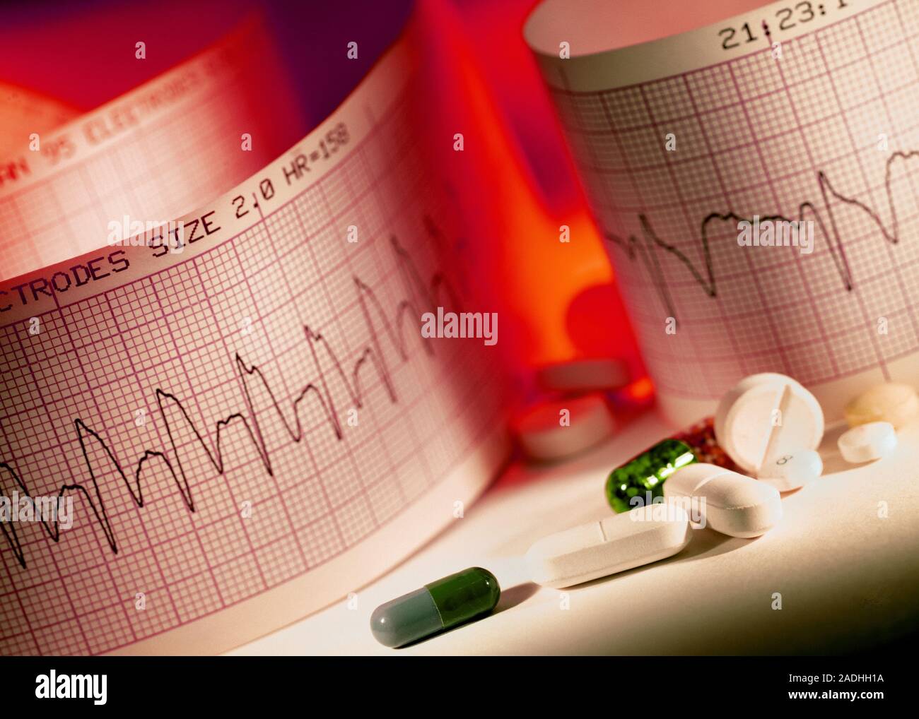Heart disease. Conceptual image of an electrocardiogram (ECG) trace and ...