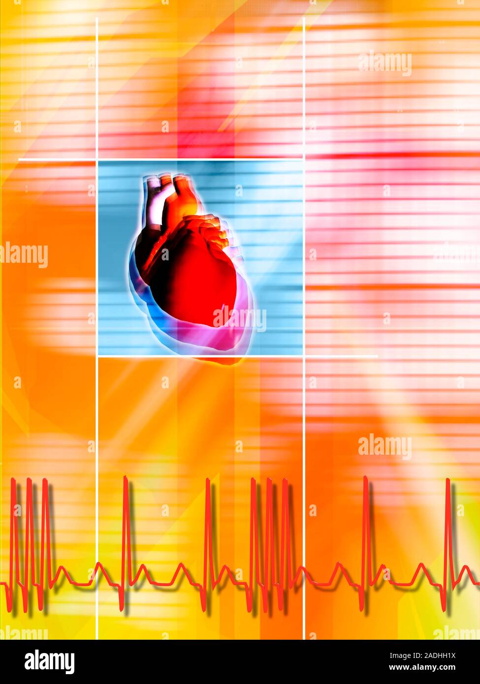 Irregular heartbeat. Conceptual computer artwork of a blurred heart and ...