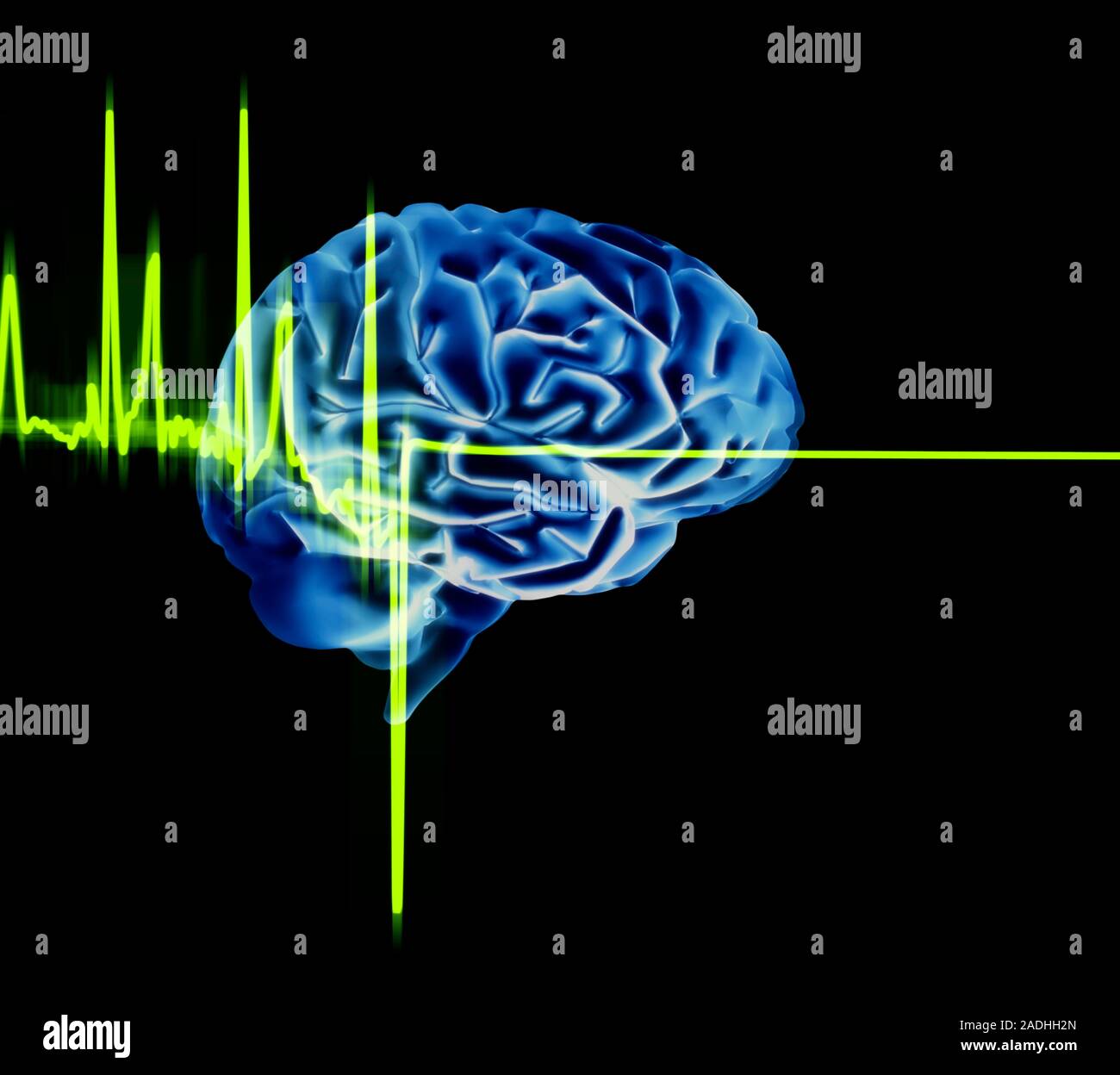 ECG trace and brain. Computer artwork of an ECG (electrocardiogram ...