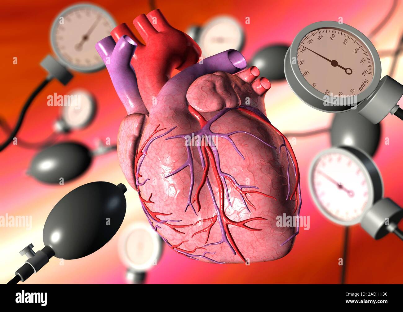High blood pressure. Computer artwork of a heart surrounded by ...