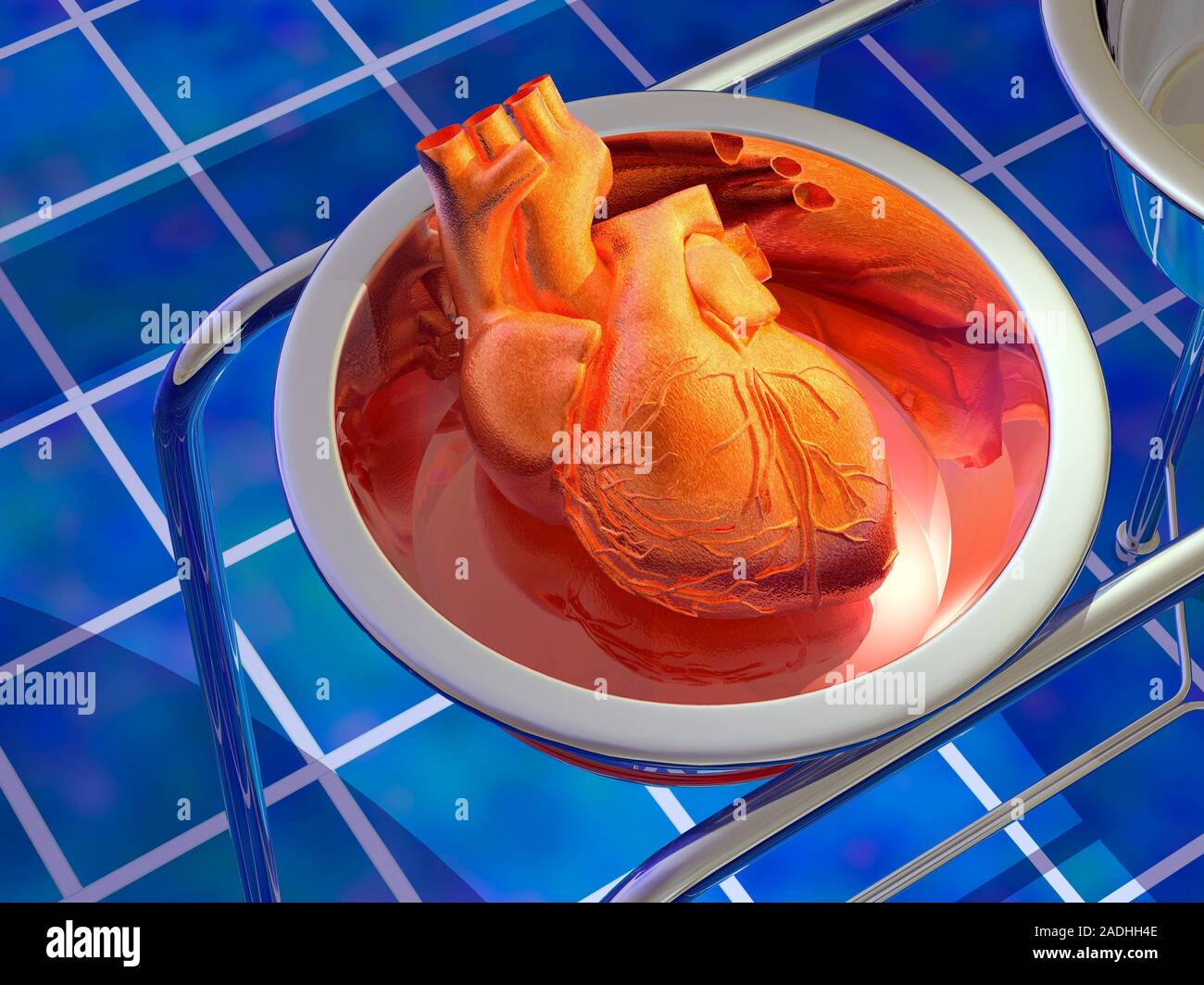 Heart surgery. Artwork of a heart in a dish during heart transplant ...