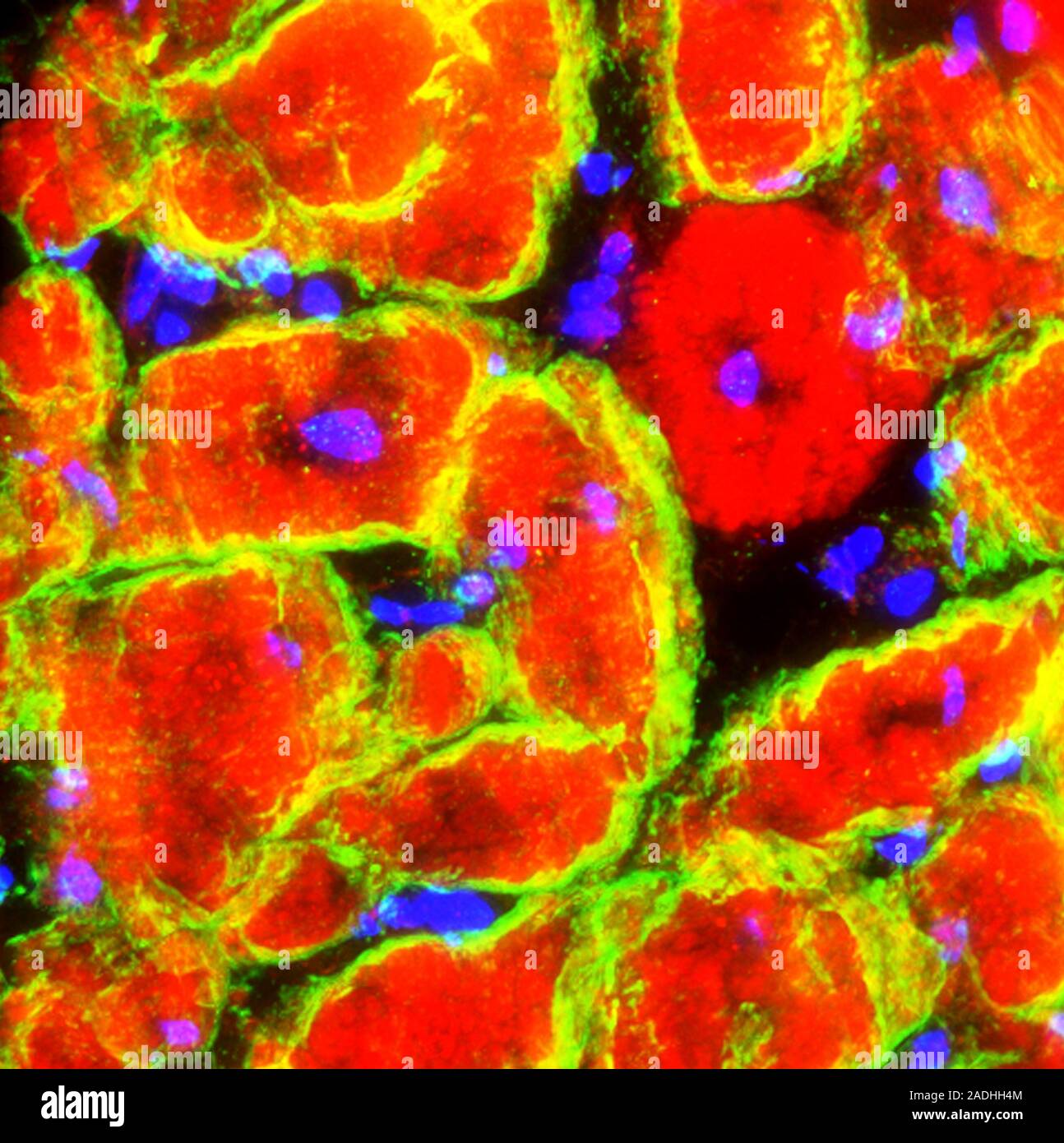 Cardiac dystrophy. Fluorescence deconvolution micrograph of a cross ...