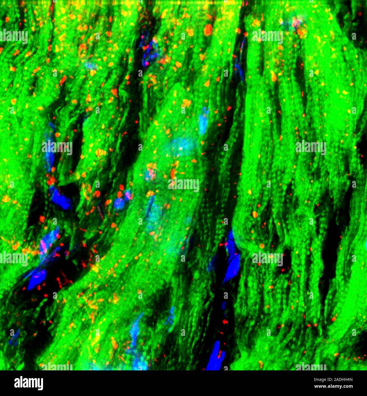 Damaged heart tissue, fluorescence deconvolution micrograph ...