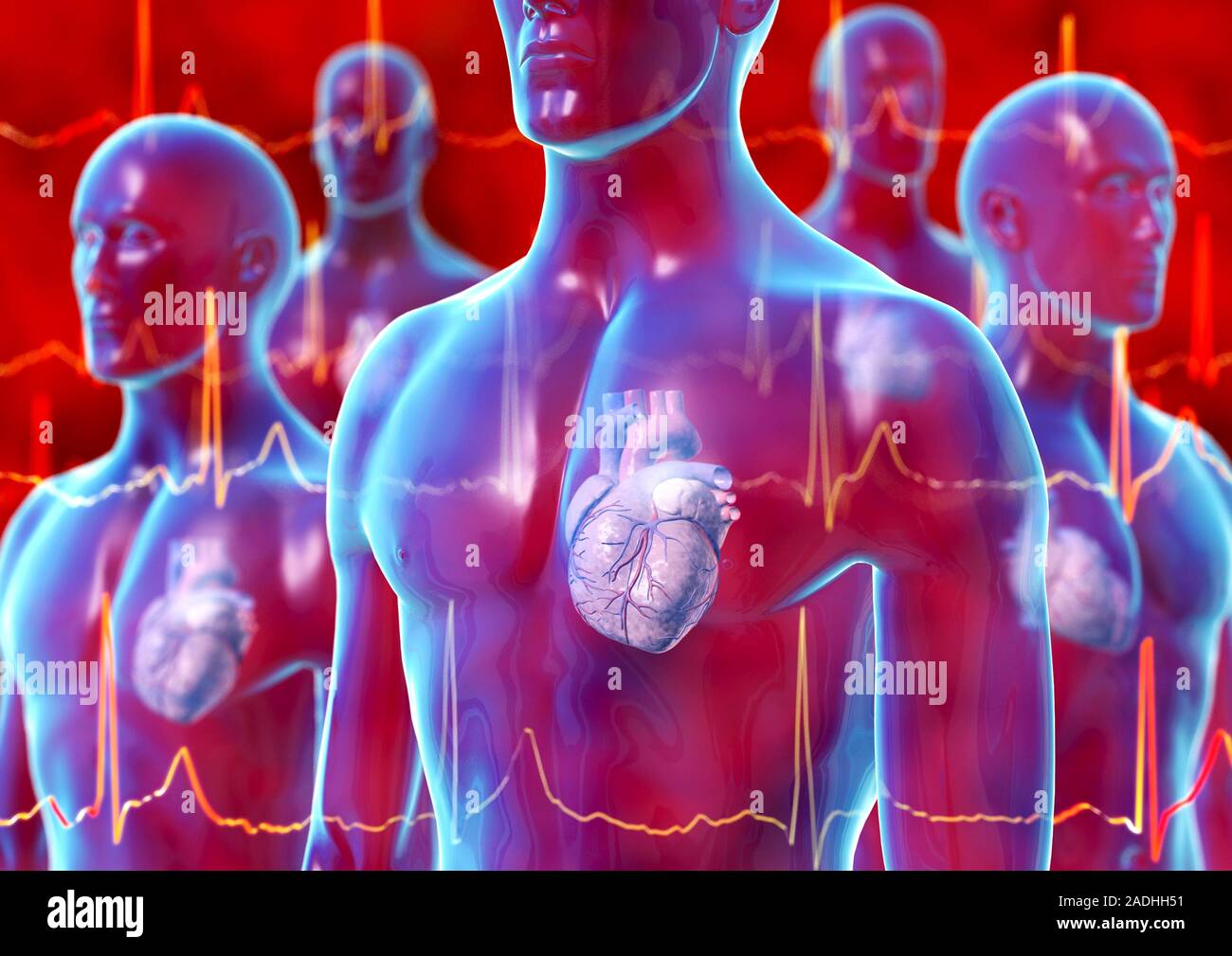 Irregular heartbeat, conceptual computer artwork. ECG ...