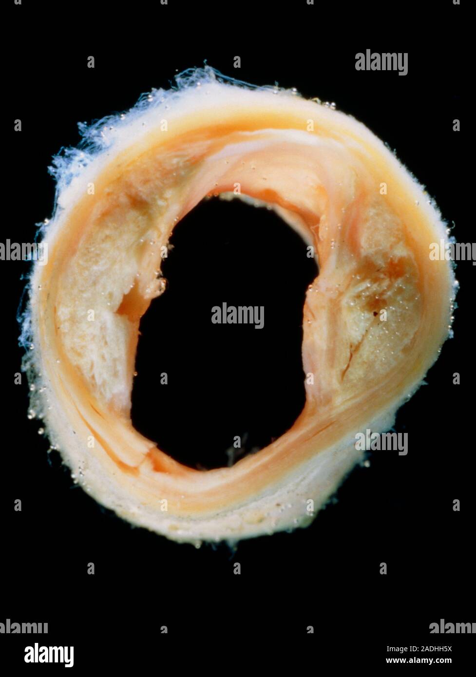 Macrophotograph of a transverse section of the human aorta showing the ...