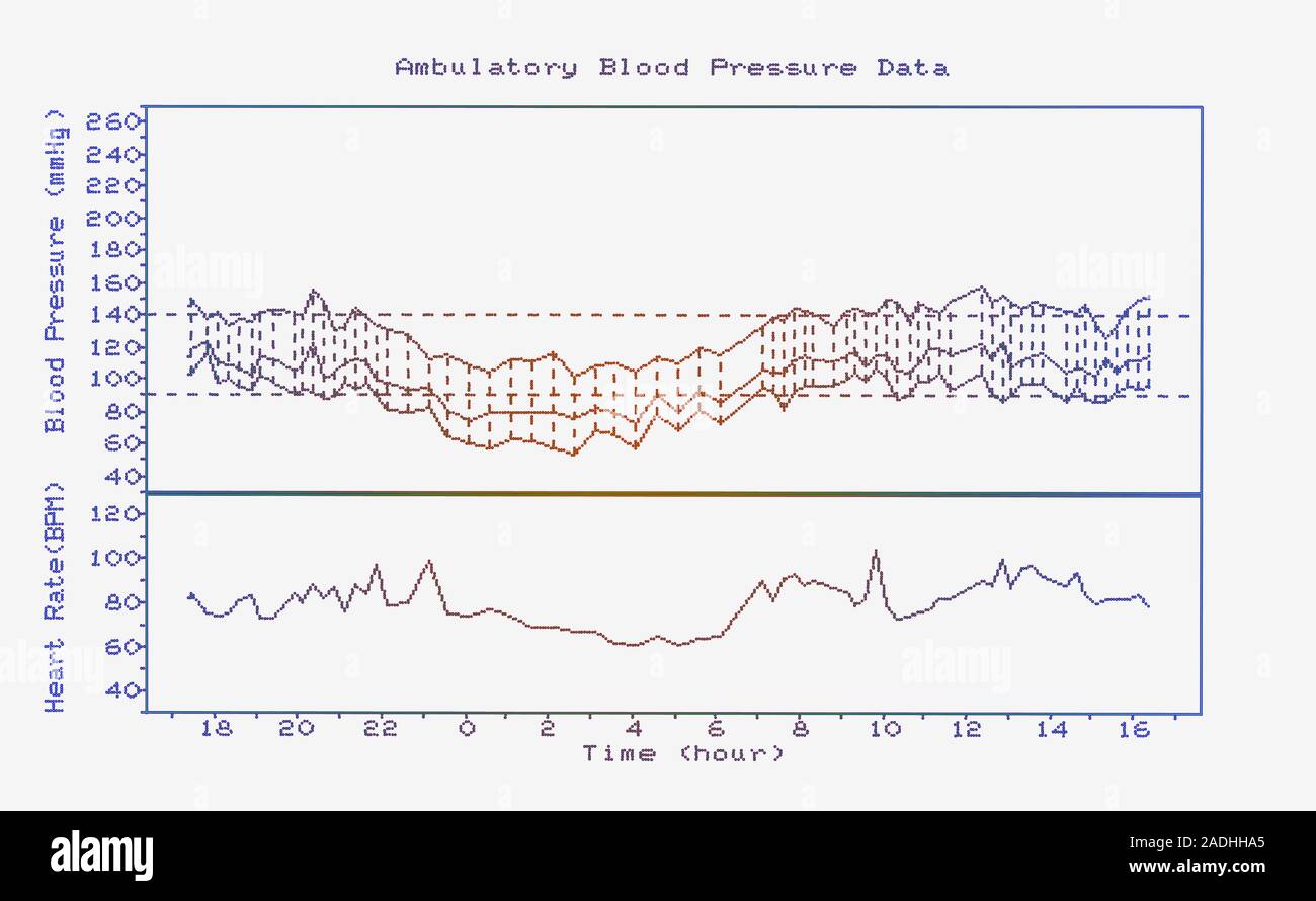 Hypertension. Graph of the blood pressure of a man with mild ...