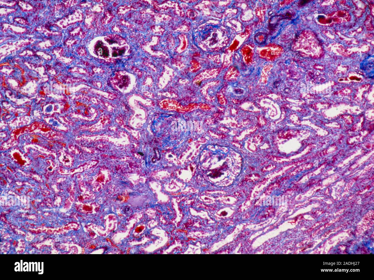 Light micrograph showing glomeruli (the dark features) in a human ...